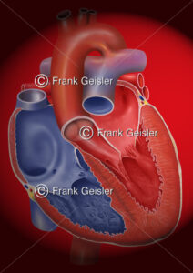 Herz mit Ductus arteriosus (Ductus arteriosus Botalli, Ductus Botalli ...