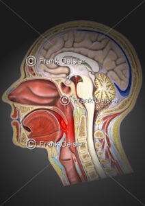 Mandelentzündung (Tonsillitis), Entzündung der Gaumenmandeln (Tonsillen ...