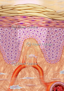 Narbe Cicatrix, Narbenbildung der Haut nach Wundheilung – Medical Pictures
